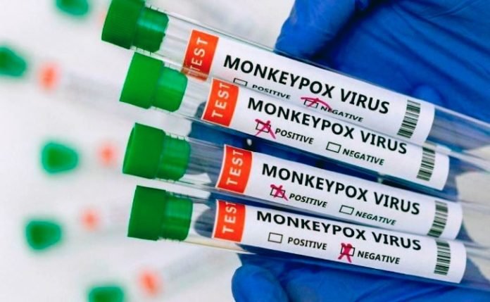 Monkeypox Virus (Mpox): History, Symptoms, and Effective Prevention ...